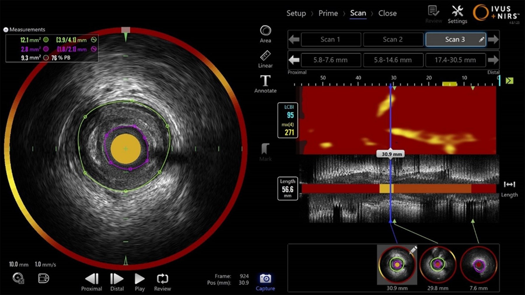 Experiencia inicial con espectroscopia de infrarrojo cercano en el ...