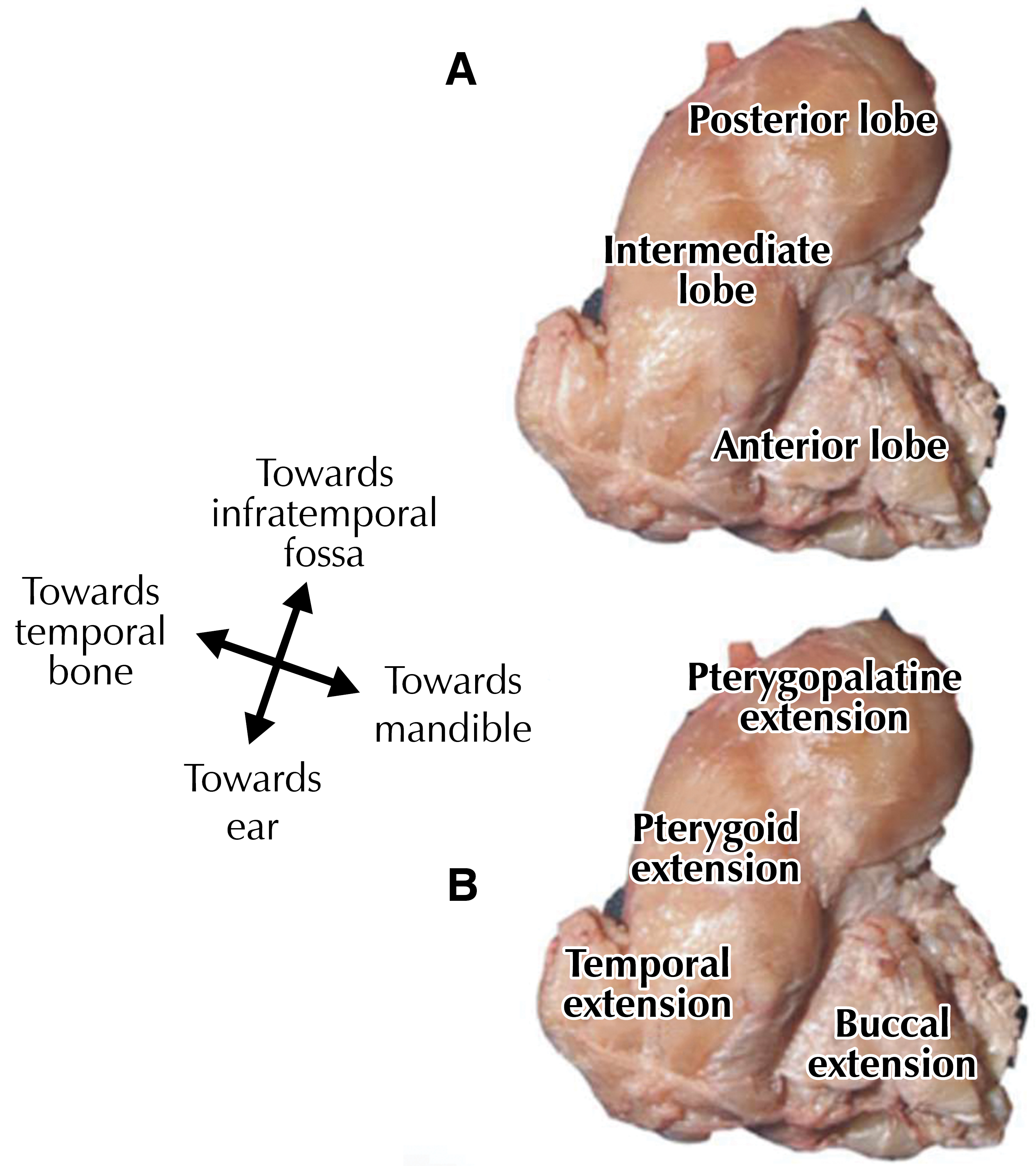 Bola adiposa de Bichat: anatomía y técnicas quirúrgicas. Revisión de la literatura