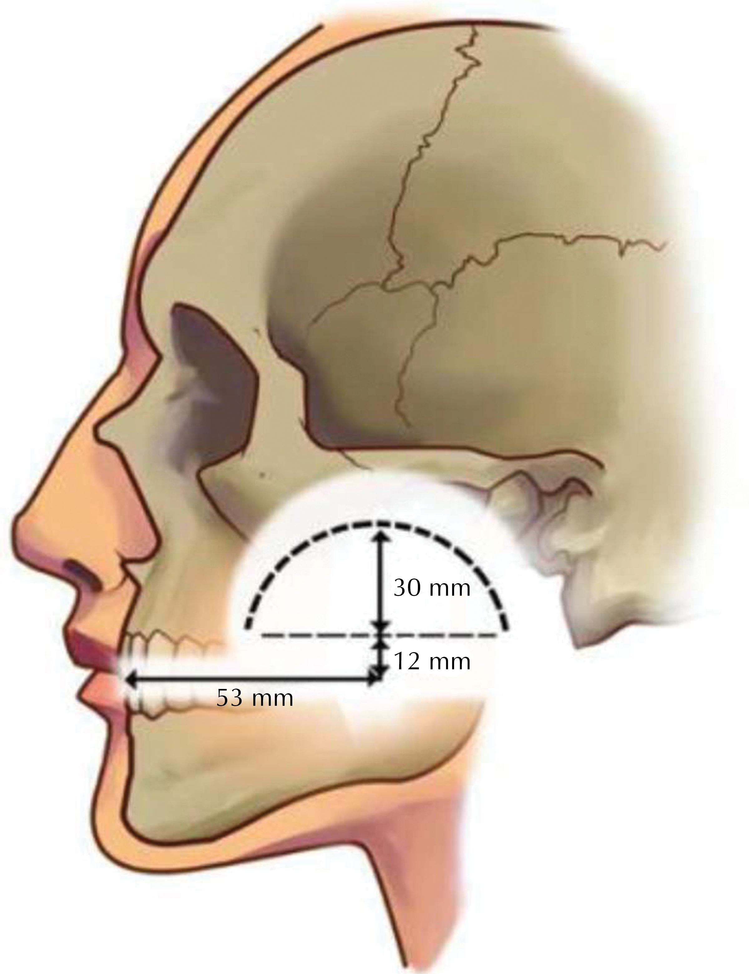 Bola adiposa de Bichat: anatomía y técnicas quirúrgicas. Revisión de la literatura
