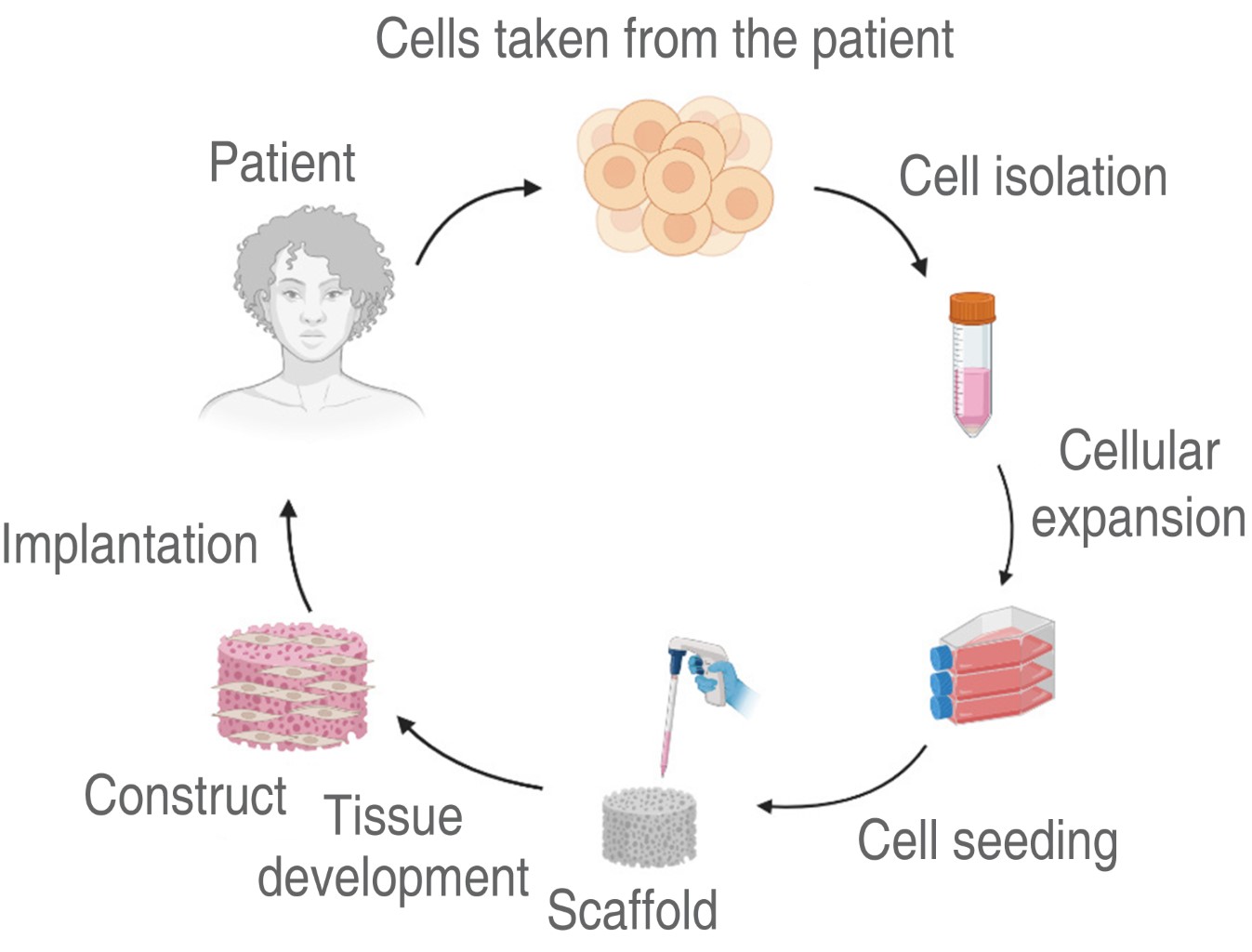 Tissue engineering in bone regeneration